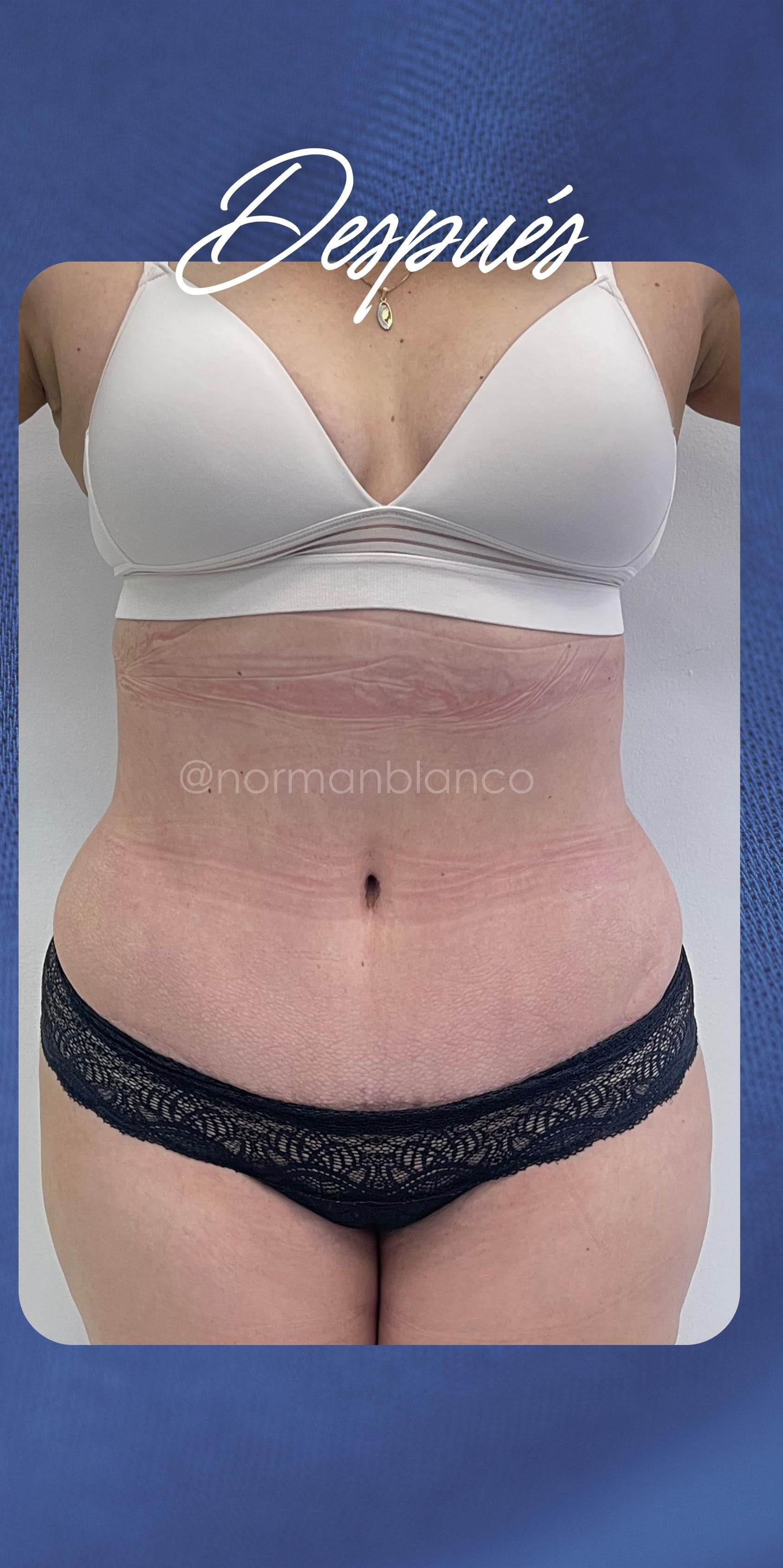 Galería - dr-normanblanco.com